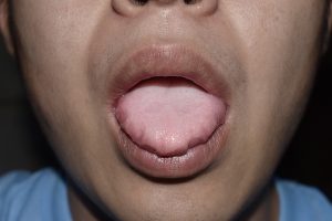 What Your Tongue Reveals About Your Health - UniScience Blog